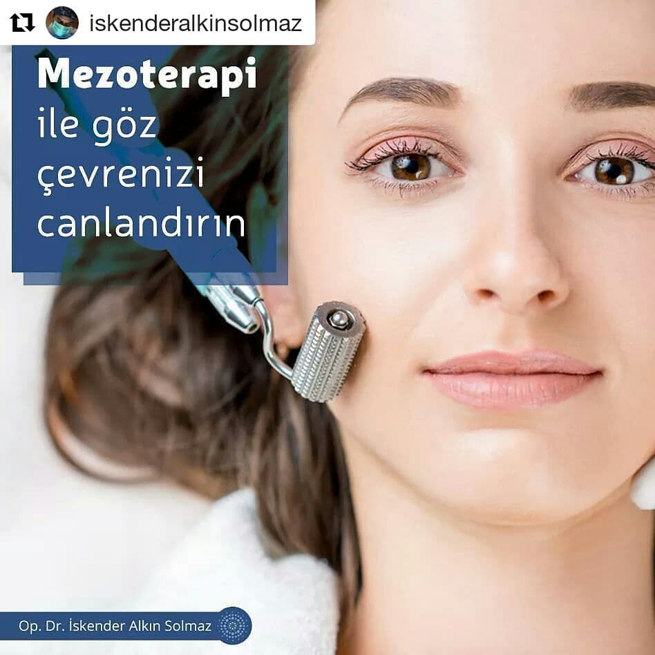 #Repost @iskenderalkinsolmaz (@get_repost) ・・・ Mezoterapi uygulamasıyla ...